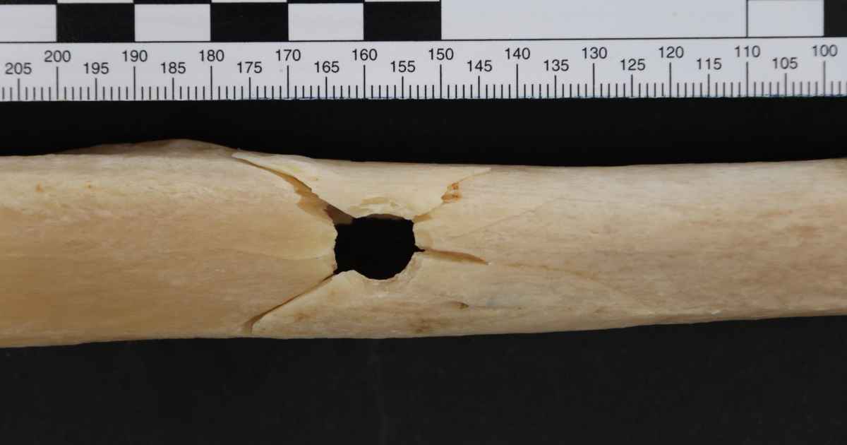 Analysis of ballistic trauma in human long bones - Co van Ledden ...