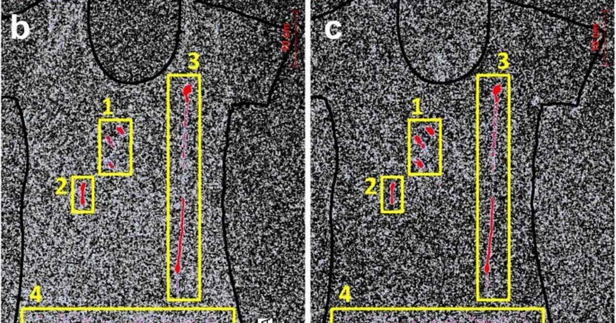 Imaging techniques for a Multidisciplinary Forensic Scan Table - Co van ...